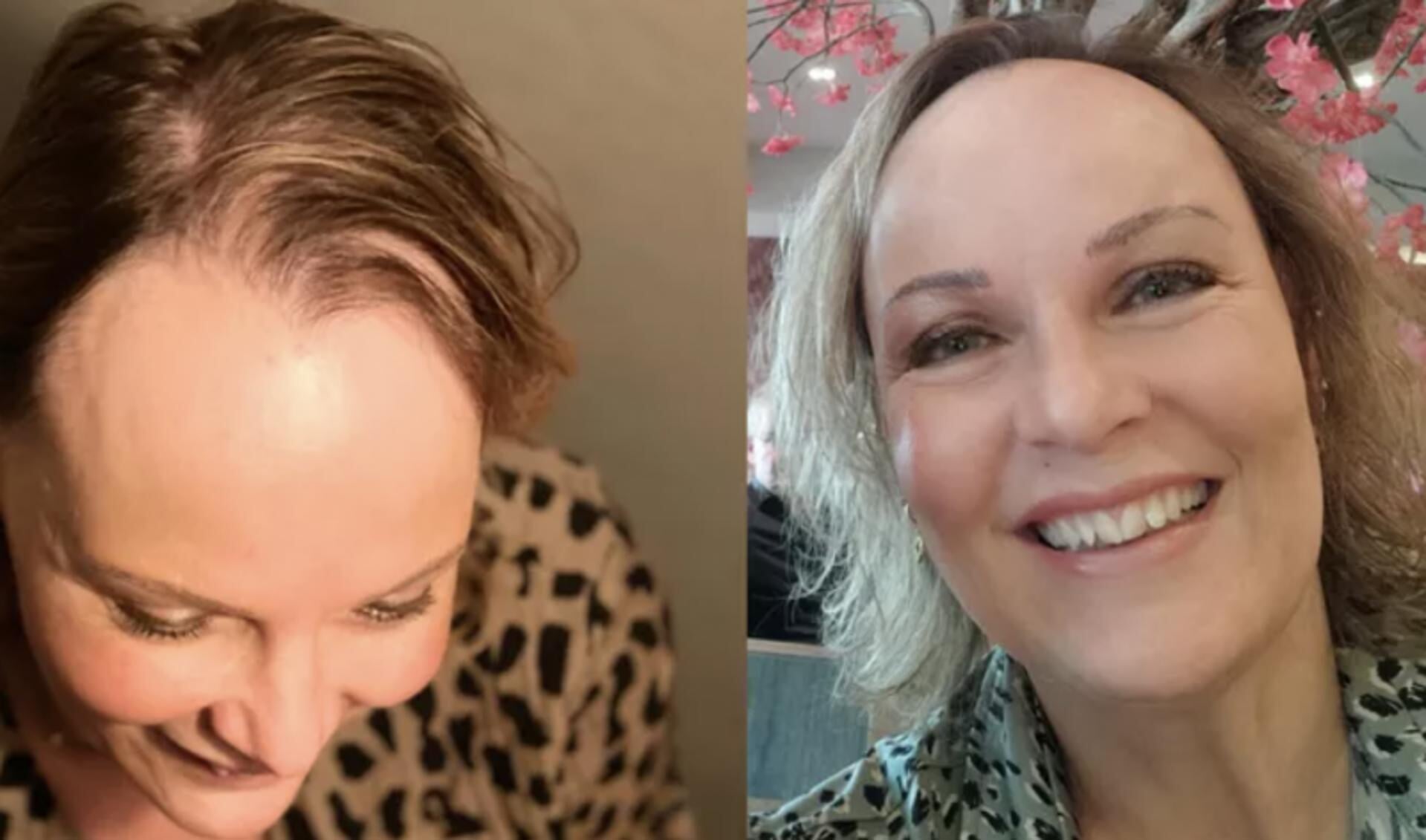 Kinderen starten inzamelingsactie voor moeder - Adverteren ... Kinderen starten inzamelingsactie voor moeder - Adverteren ...